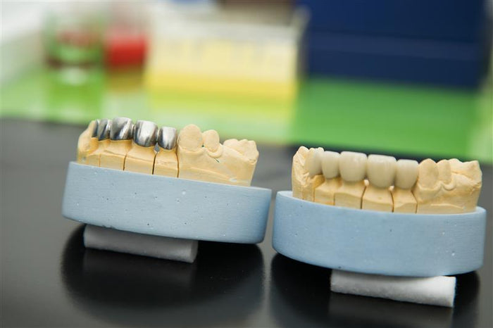 Types of Dental Crown Materials Compared: Zirconia vs Ceramic vs PMMA ...